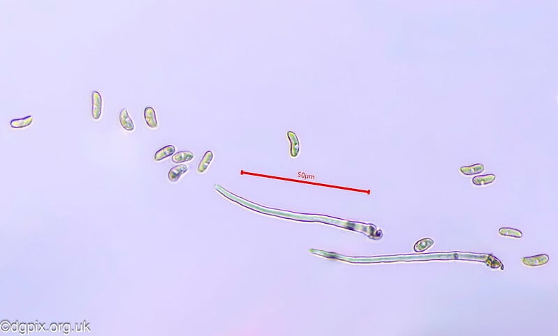 Microscopic Mycology