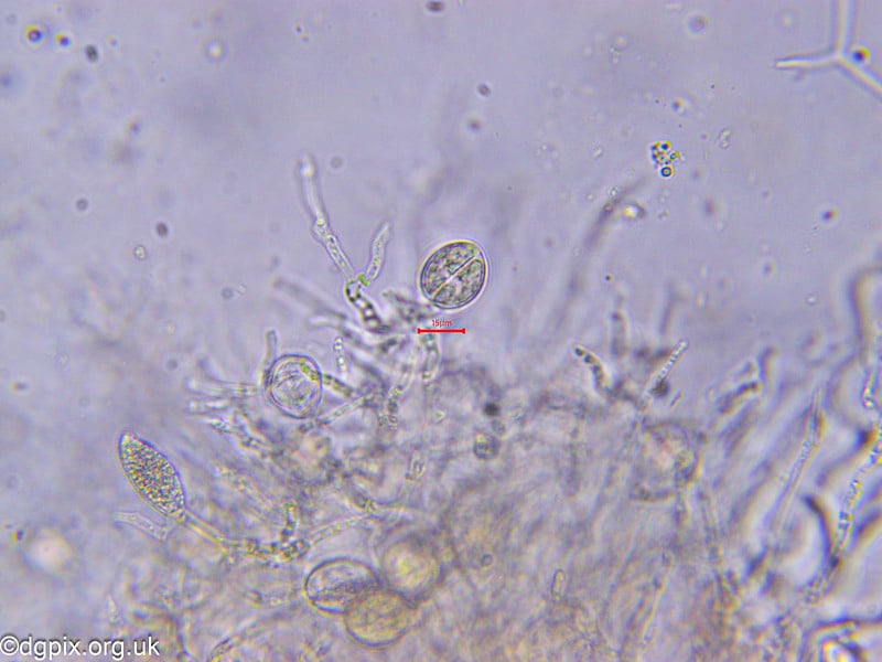 Microscopic Mycology